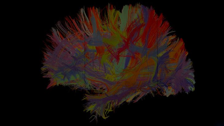 IBM and SAP to deliver cognitive capabilities